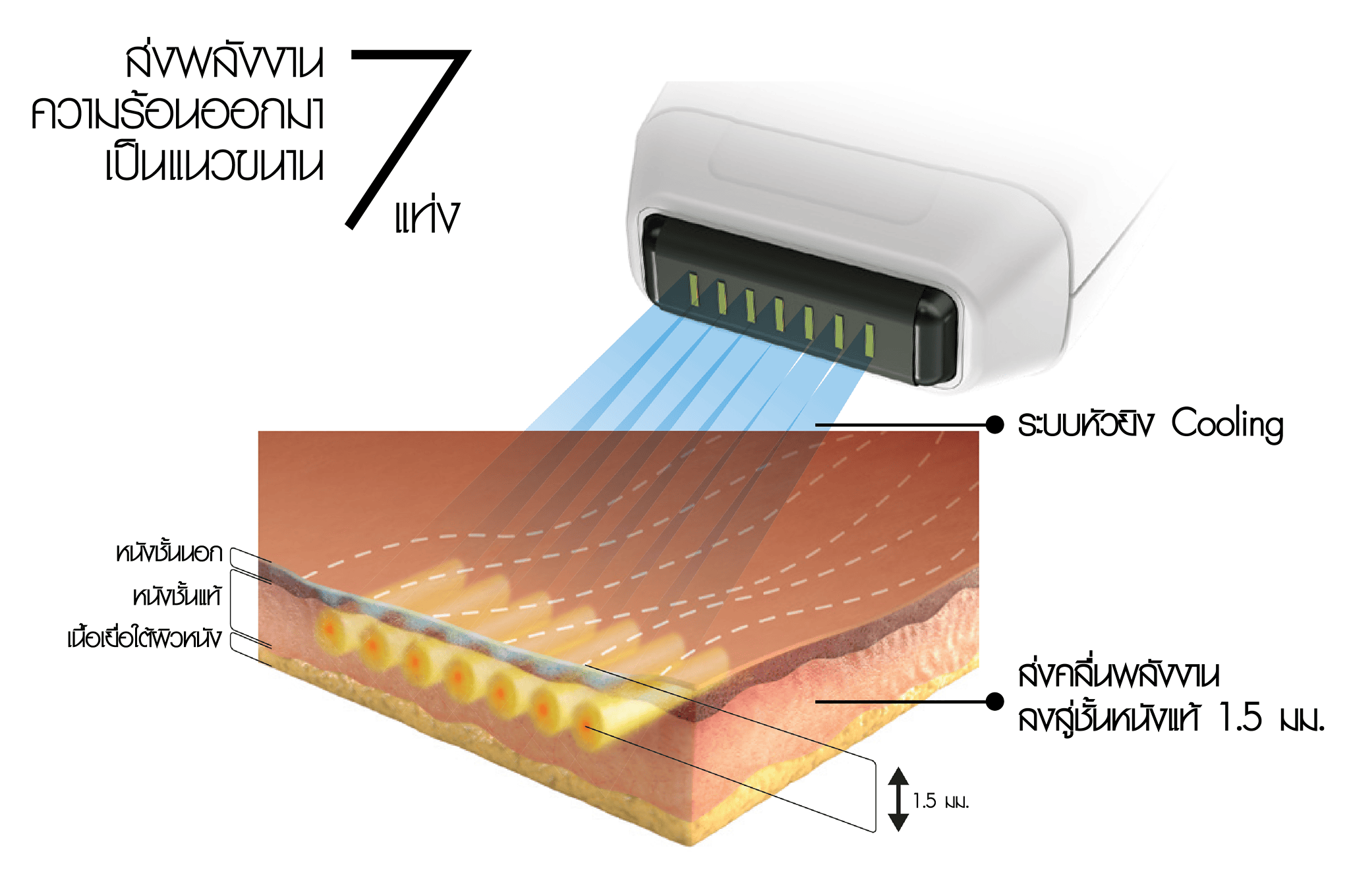 Sofwave นวัตกรรมยกกระชับใหม่ล่าสุดจาก USA - Privato Clinic