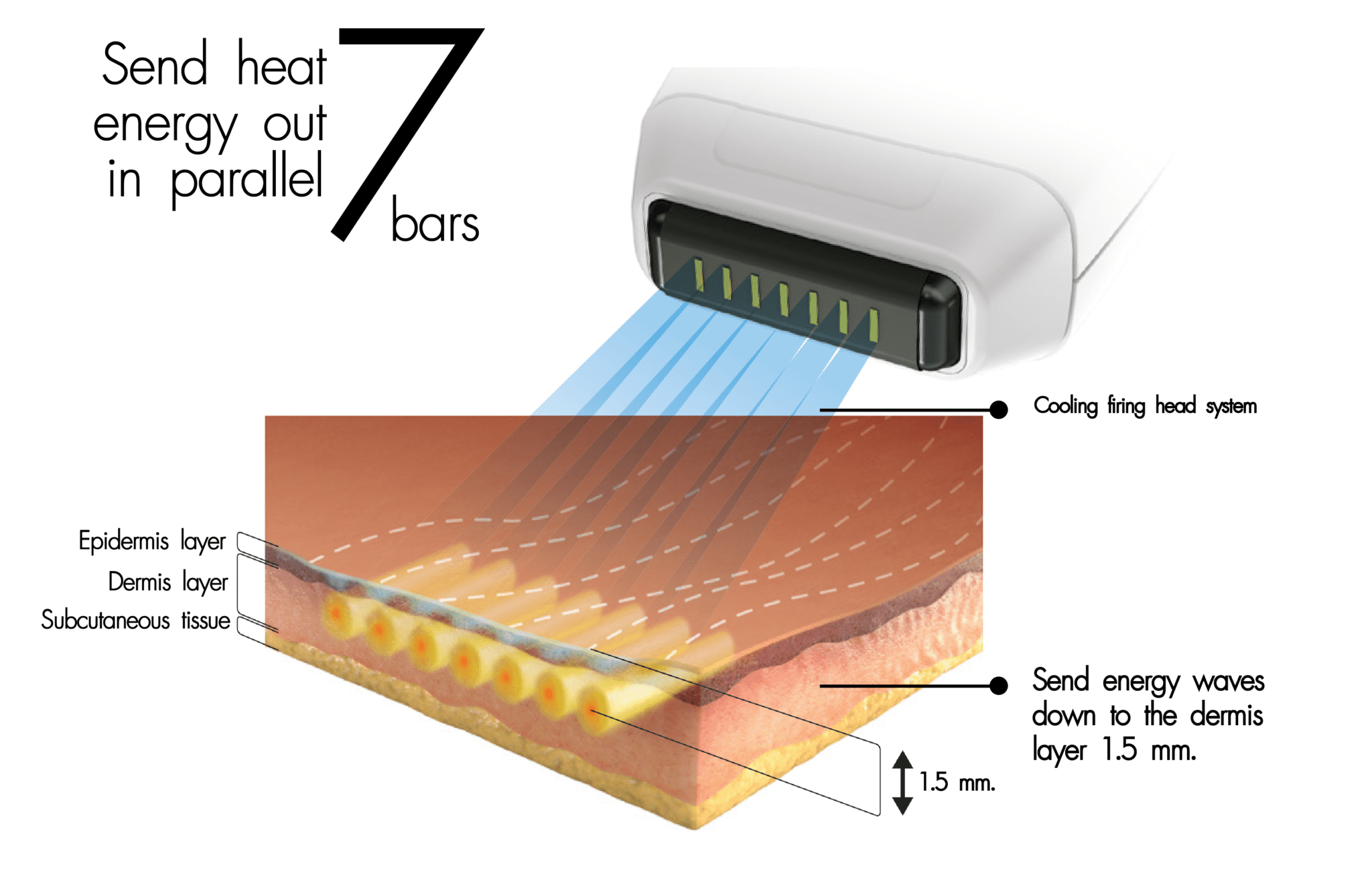 Sofwave Laser Skin Skin Tightening Treatment - Privato Clinic