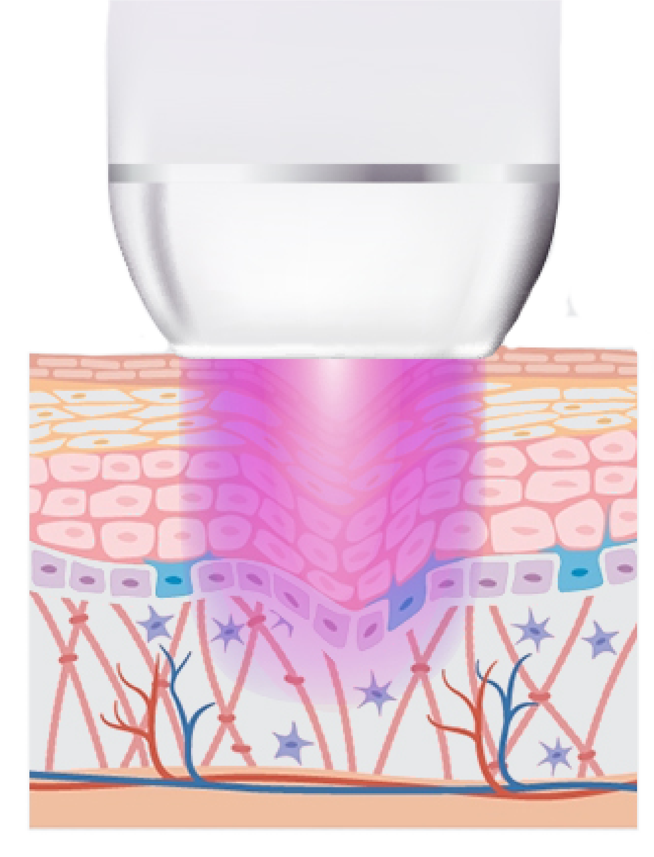 Thermage FLX - eng - Privato Clinic - Innovation Of Beauty | Bangkok